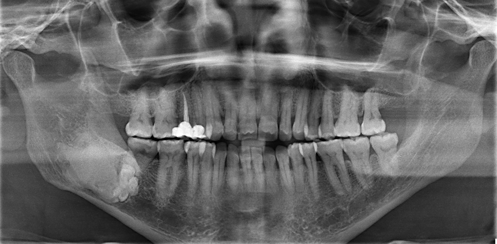 Oral Radiology : U of MN