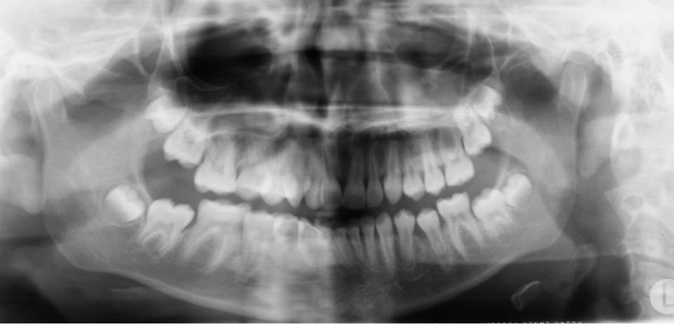 Oral Radiology : U of MN